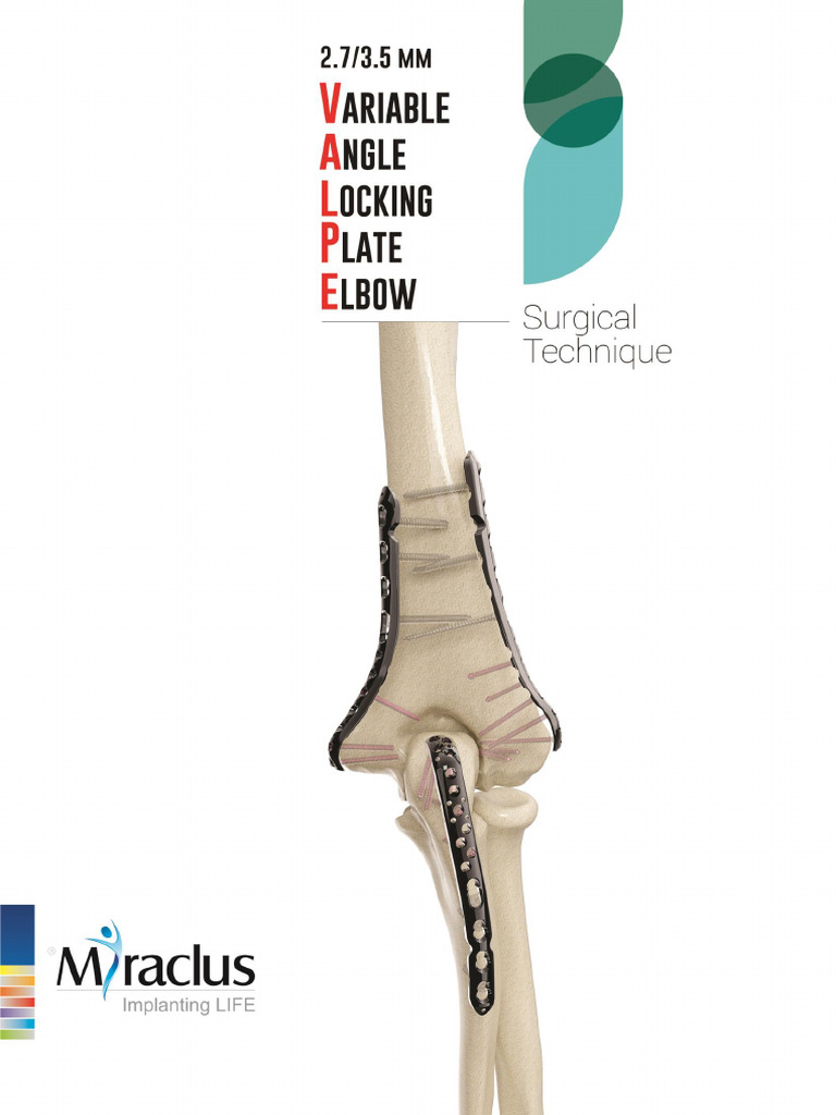 Variable Angle Locking Plate Elbow | PDF | Screw | Drill