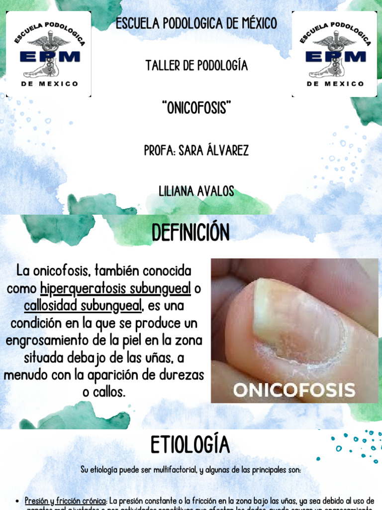 Onicofosis: Causas y Tratamientos | PDF | Clavo (anatomía) | Piel