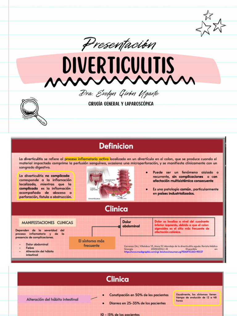 Diverticulitis | PDF