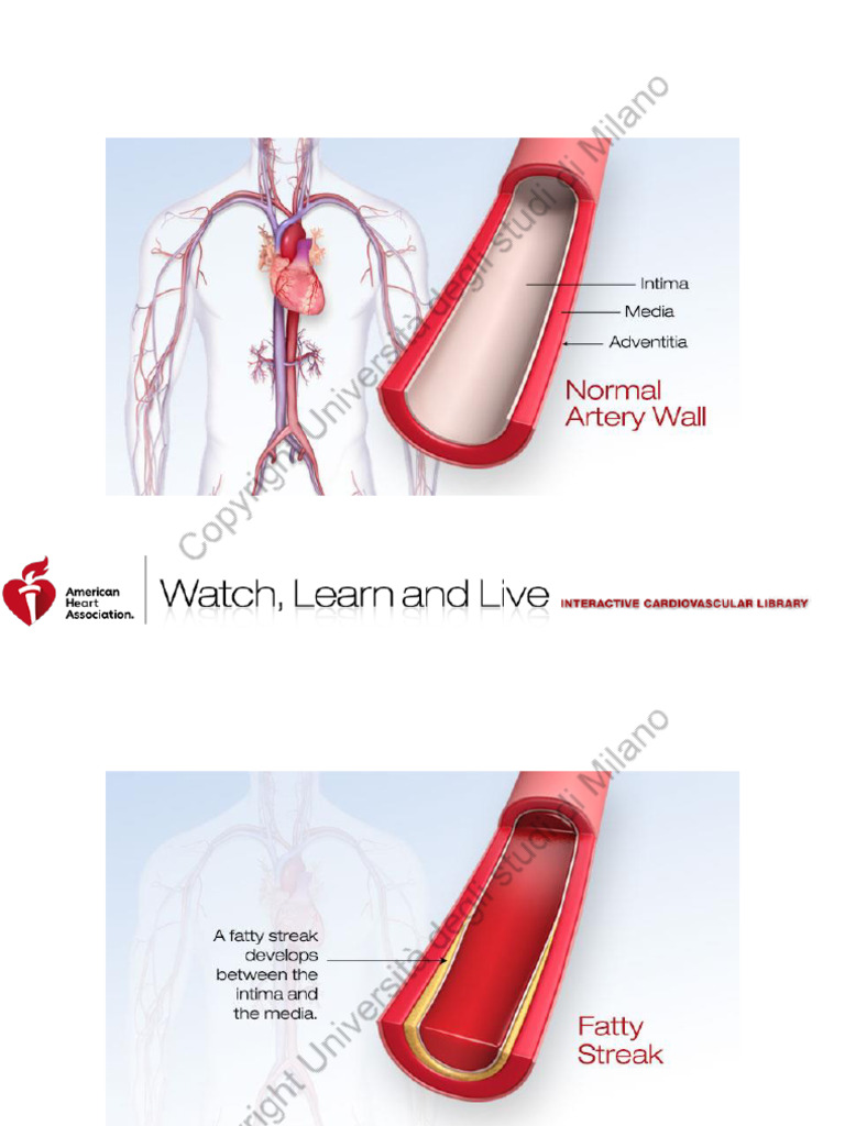 02 Athero Angiogenesis 2024 - Watermark | PDF | Thrombus | Endothelium