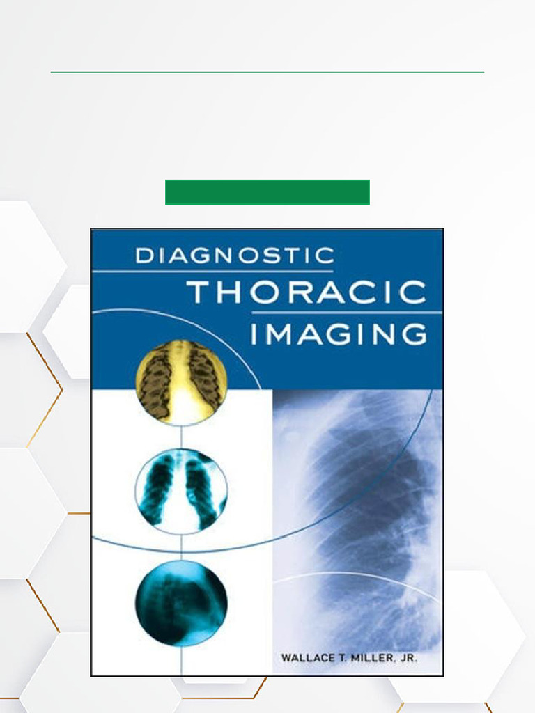 Diagnostic Thoracic Imaging Book Download | PDF