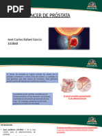 Infografia Cancer Prostata | PDF | Cancer de prostata | Cáncer