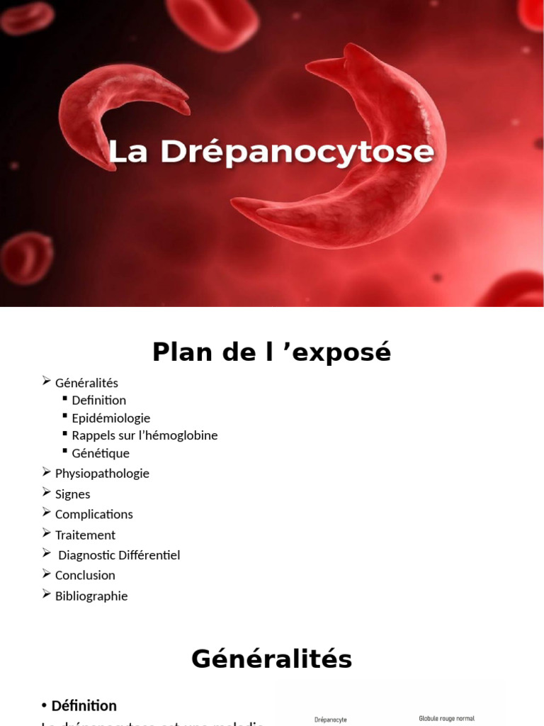 La drepanocytose | PDF | Hémoglobine | Spécialités médicales