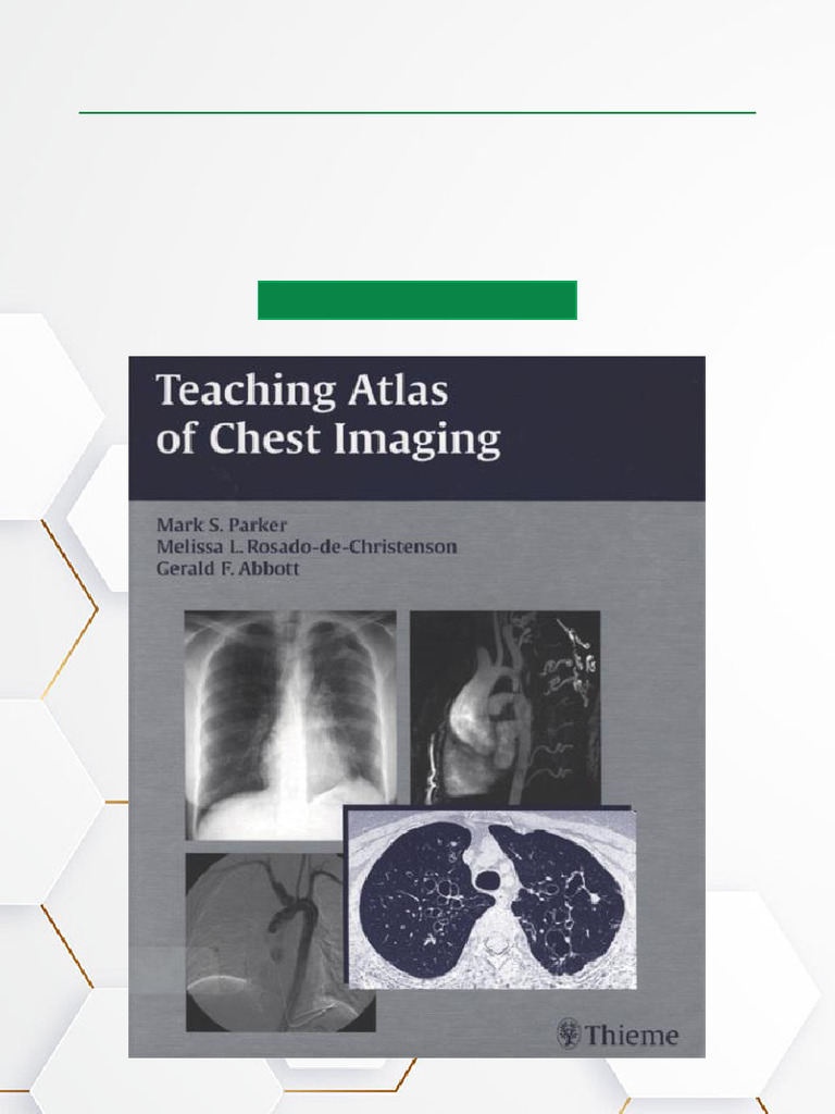 Teaching Atlas of Chest Imaging 1st Edition Research PDF Download | PDF ...