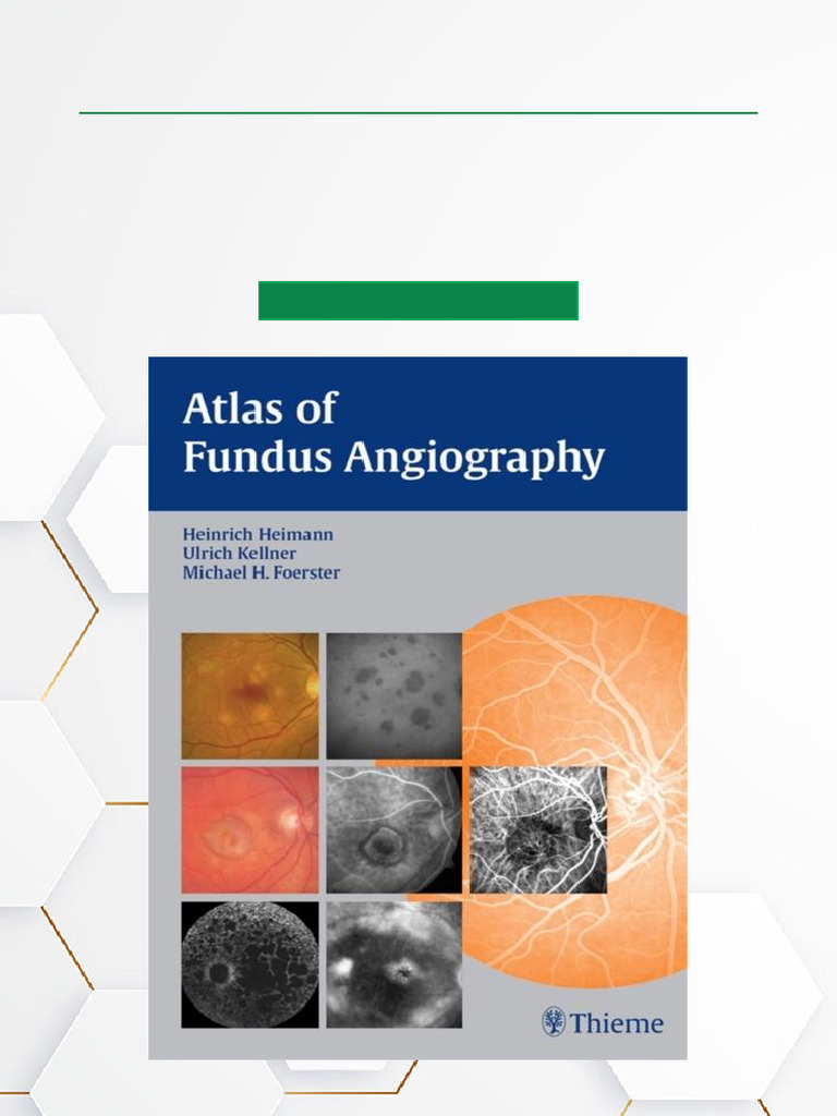 Atlas of Fundus Angiography 1st Edition FULL PDF DOCX DOWNLOAD | PDF