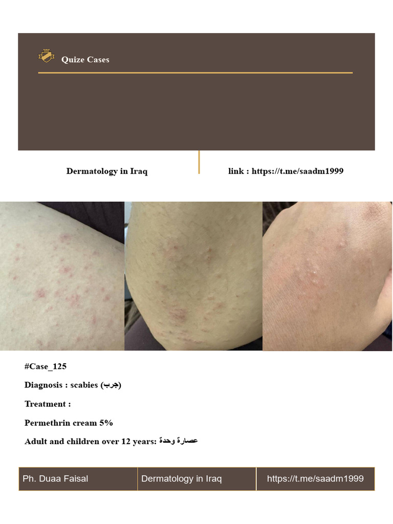 Dermatology in Iraq | PDF