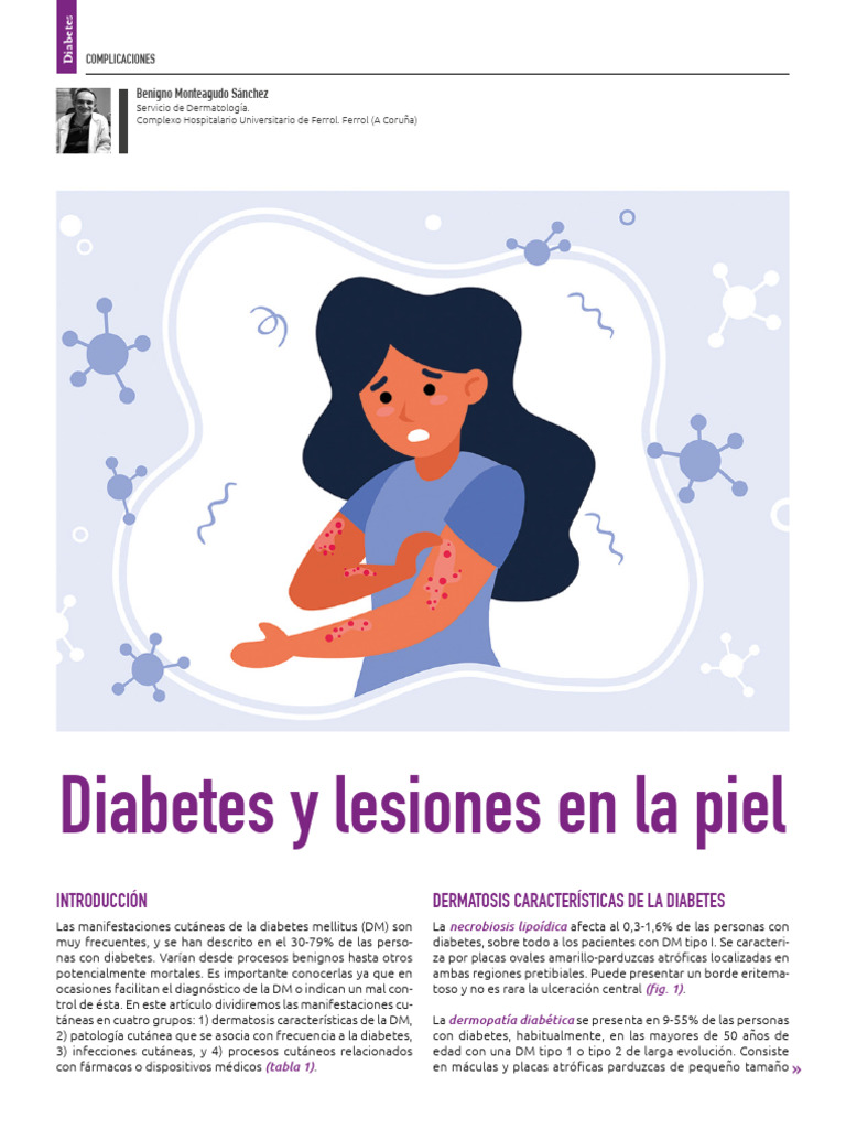 Diabetes y Lesiones en La Piel | PDF | Diabetes | Clavo (anatomía)