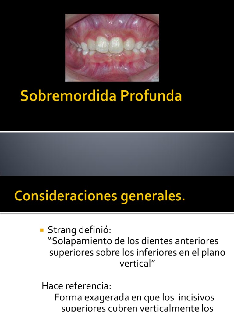 Sobremordida Profunda Completo | PDF | Diente humano | Ortodoncia