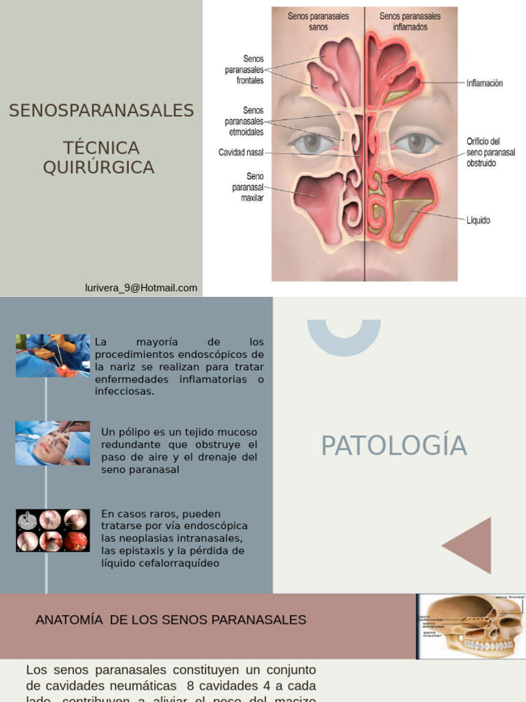 Ténica de Senos Paranasales | PDF | Anatomía humana | Especialidades Medicas