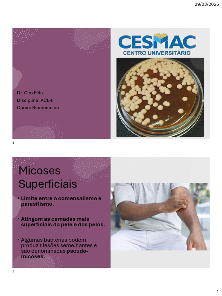 Dermatofitose e Pitiríase Versicolor | PDF | Pele
