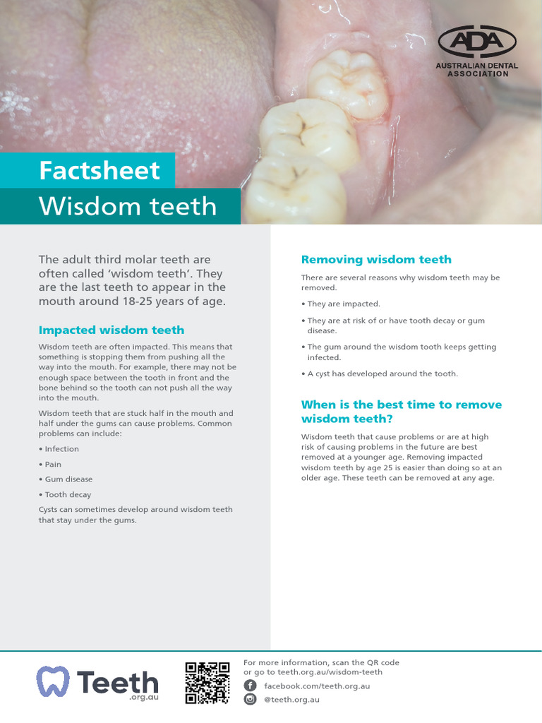 Ada2022 Factsheet Wisdom Teeth | PDF