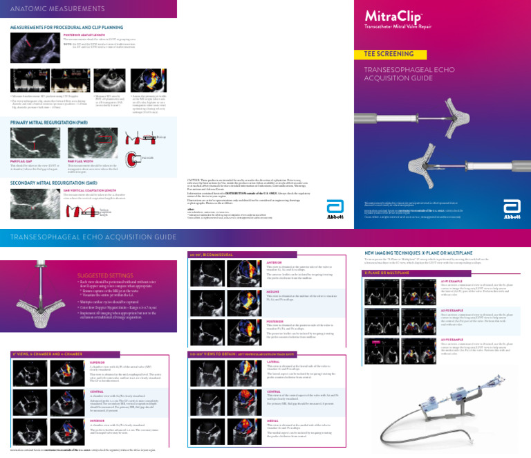 MitraClip Echo Acquisition Guidance | PDF | Cardiology | Heart