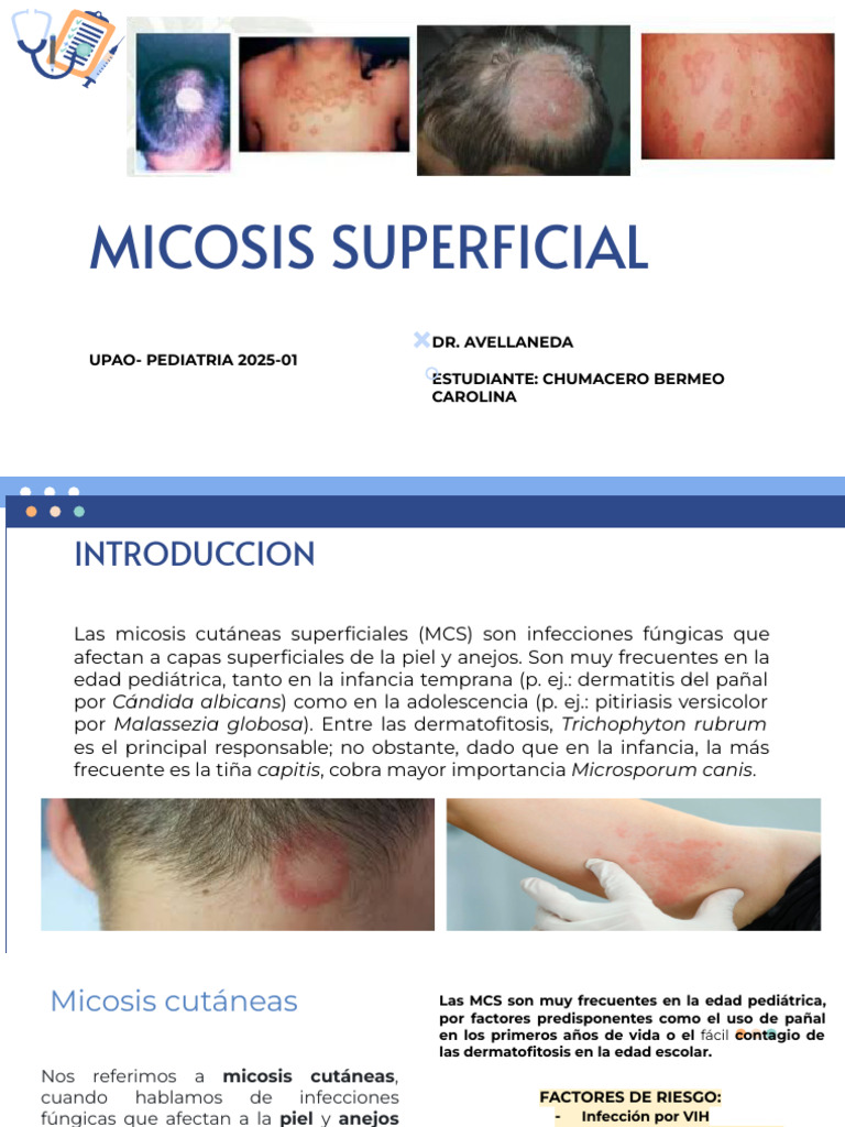 Micosis Superficial | PDF | Micología | Microbiología