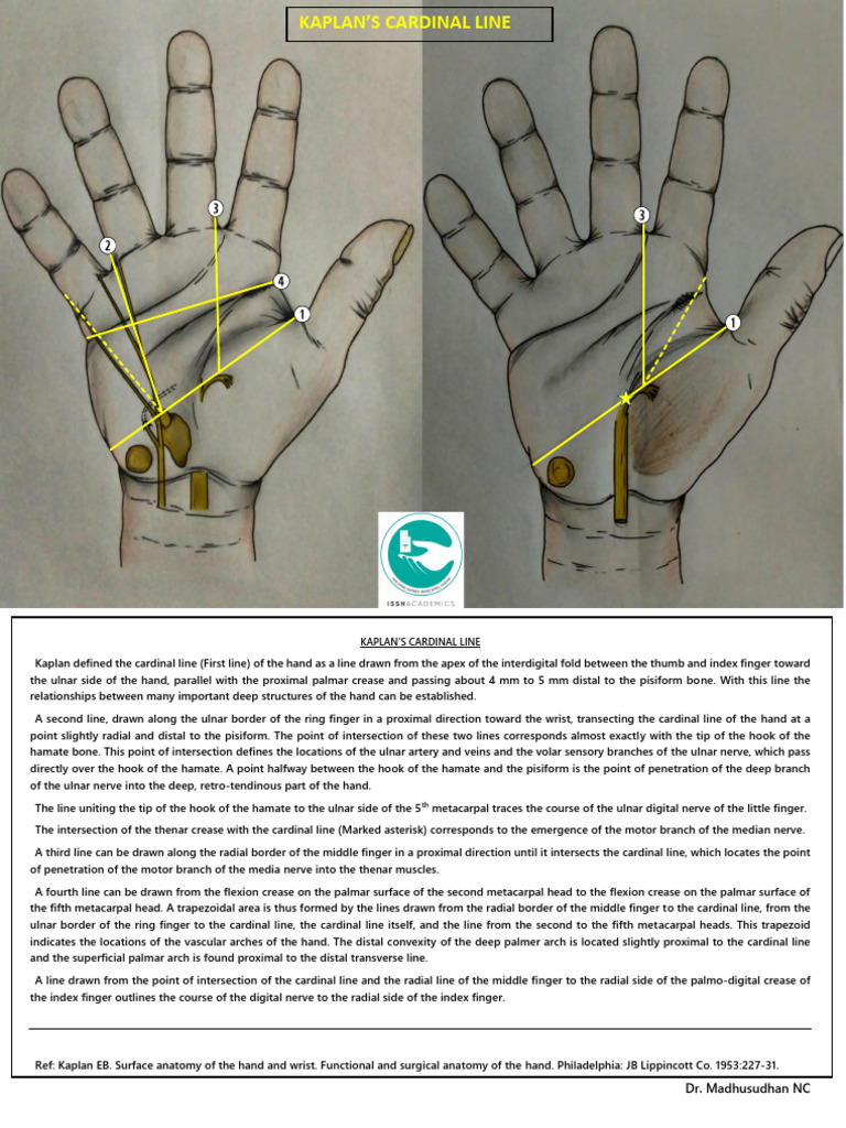 Kaplan's Cardinal Line in Hand Anatomy | PDF | Hand | Finger
