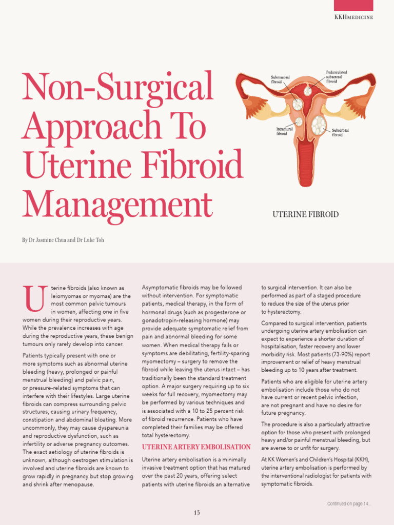 Non-Surgical Approach To Uterine Fibroid Management - Special Delivery ...