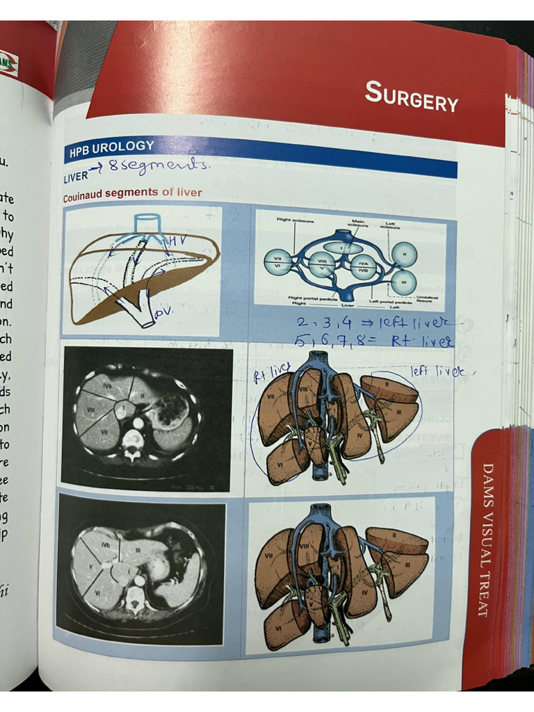 DVT Surg Liver and Uro | PDF