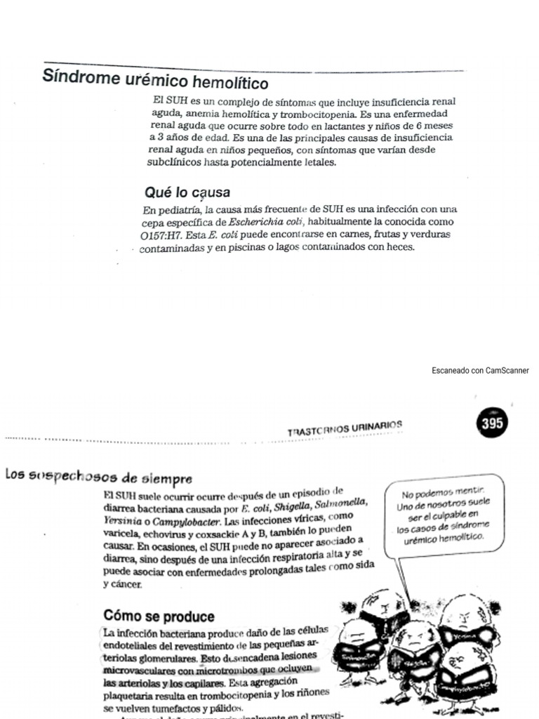SHU - Síndrome Nefrotico | PDF
