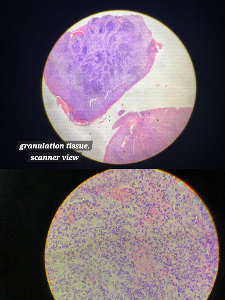 Till 2nd Internal (2024) Patho Slides | PDF