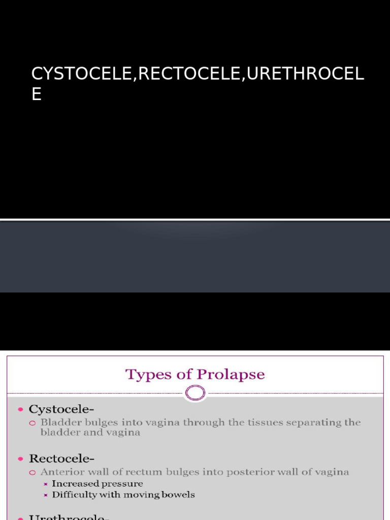 Cystocele Rectocele Urethrocele | PDF | Urinary Incontinence | Medical ...