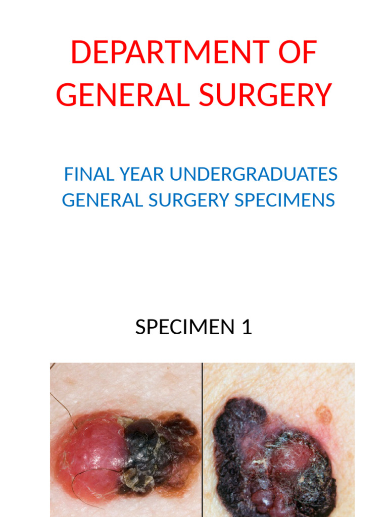 General Surgery Specimen Overview | PDF