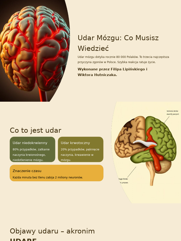 Udar Mózgu - Co Musisz Wiedzieć | PDF