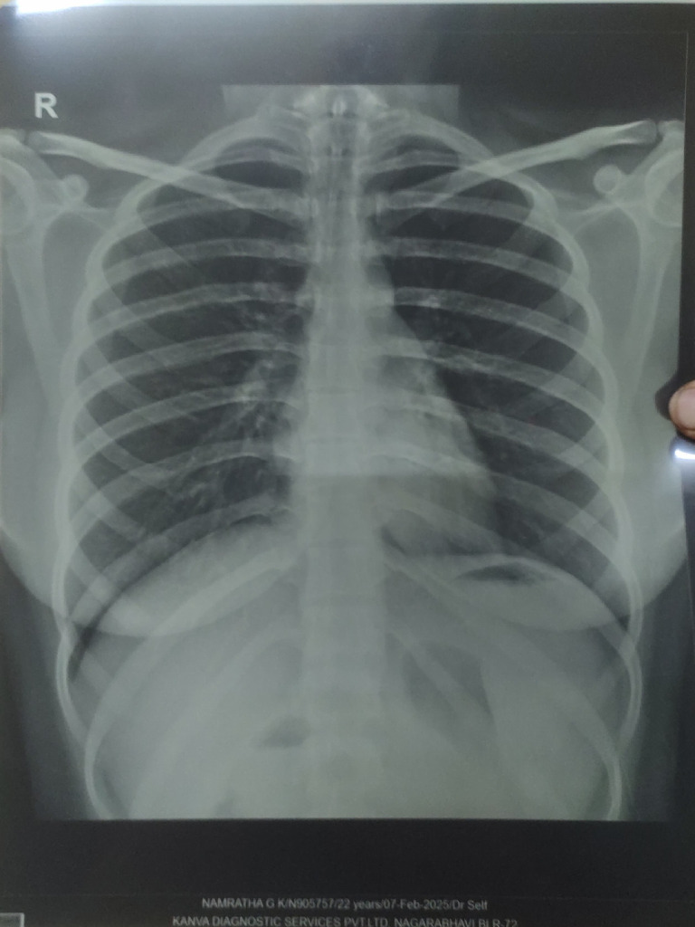 CHEST x ray | PDF