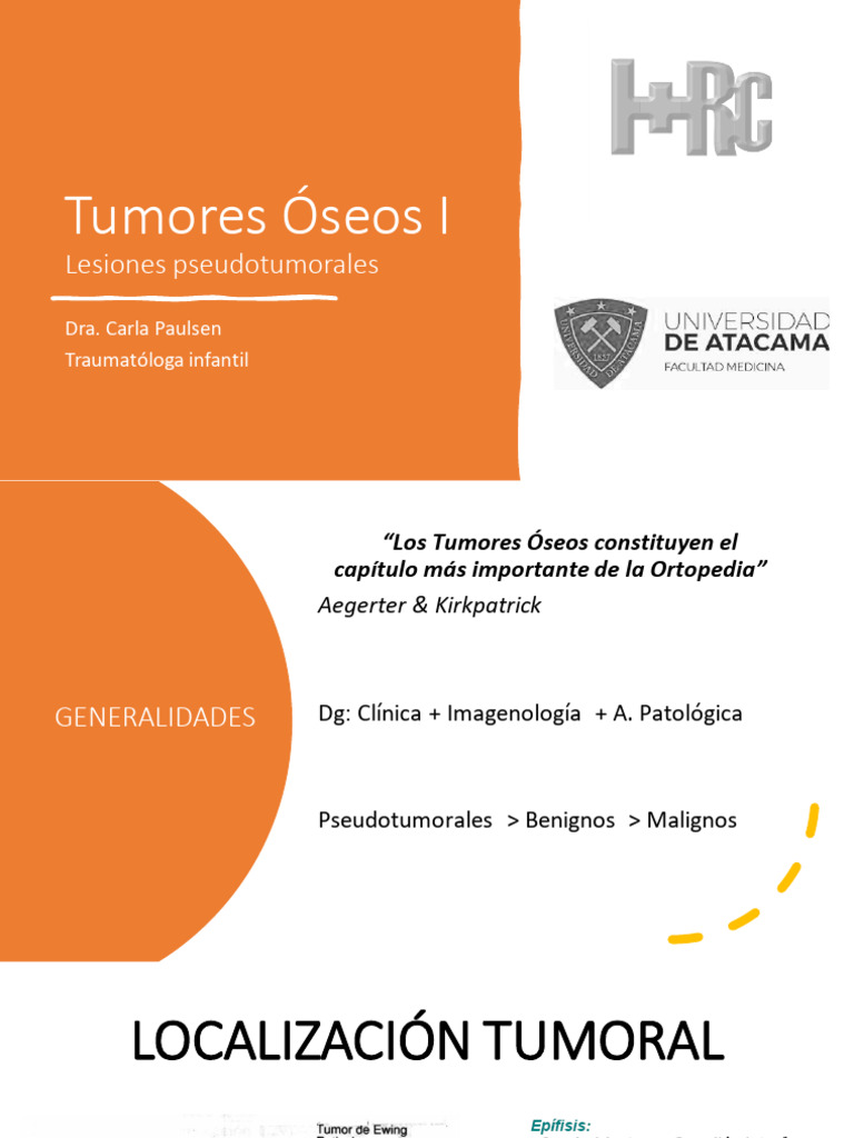Tumores óseos I | PDF | Hueso | Neoplasias