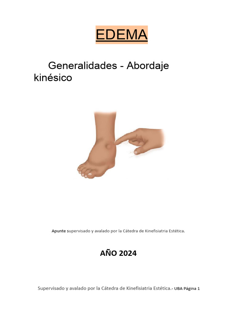 Causas y Tratamiento del Edema | PDF | Edema | Tejido adiposo