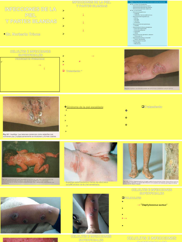 Infecciones de La Piel y Partes Blandas | PDF | Staphylococcus Aureus ...