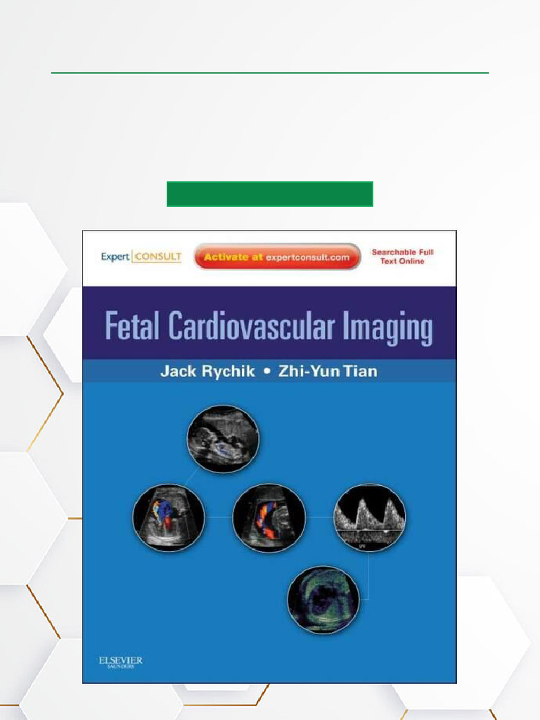 Fetal Cardiovascular Imaging A Disease Based Approach Entire Volume ...