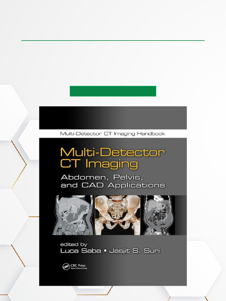 Multi-Detector CT Imaging Guide | PDF | Medical Imaging | Ct Scan