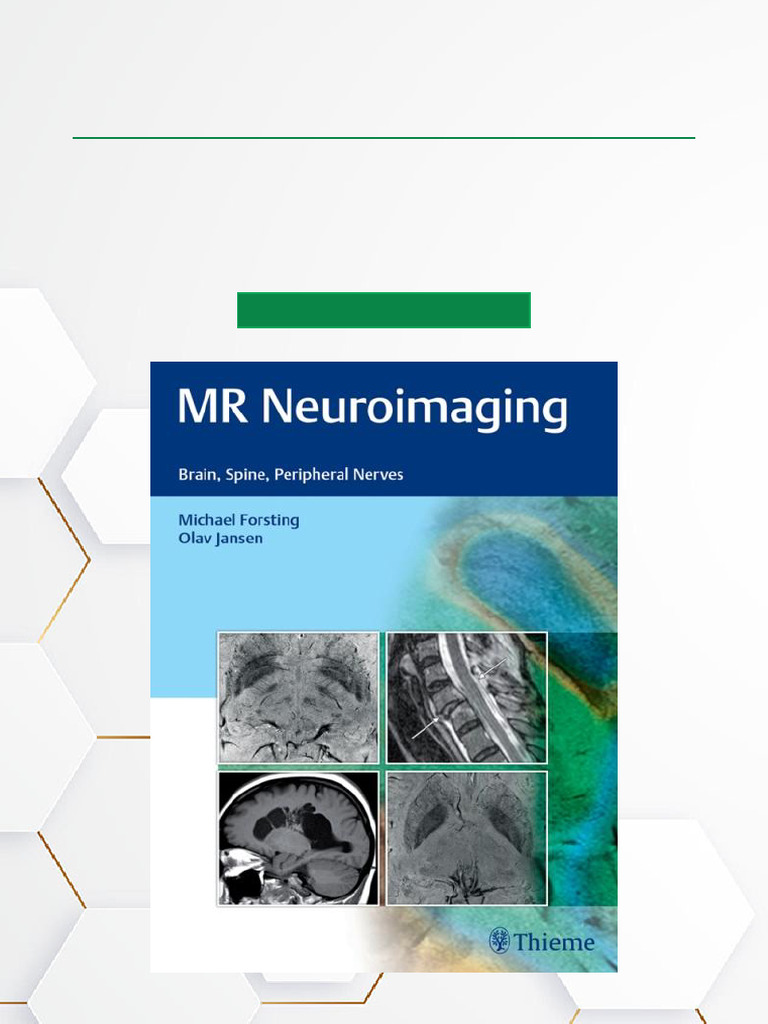 MR Neuroimaging Brain, Spine, Peripheral Nerves 1st Edition Full MOBI ...