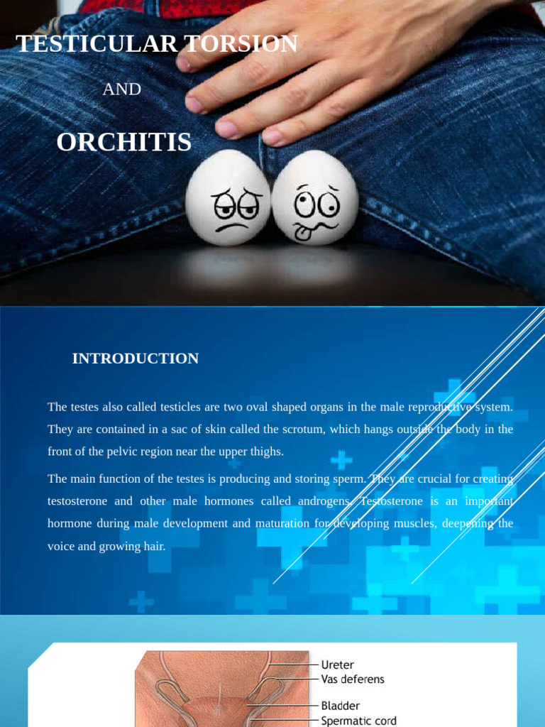 Testicular Torsion and Orchitis | PDF | Testicle | Medical Specialties