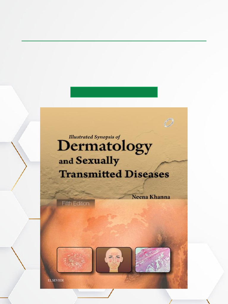 Illustrated Synopsis of Dermatology & Sexually Transmitted Diseases, 5th Edition Scribd Download ...