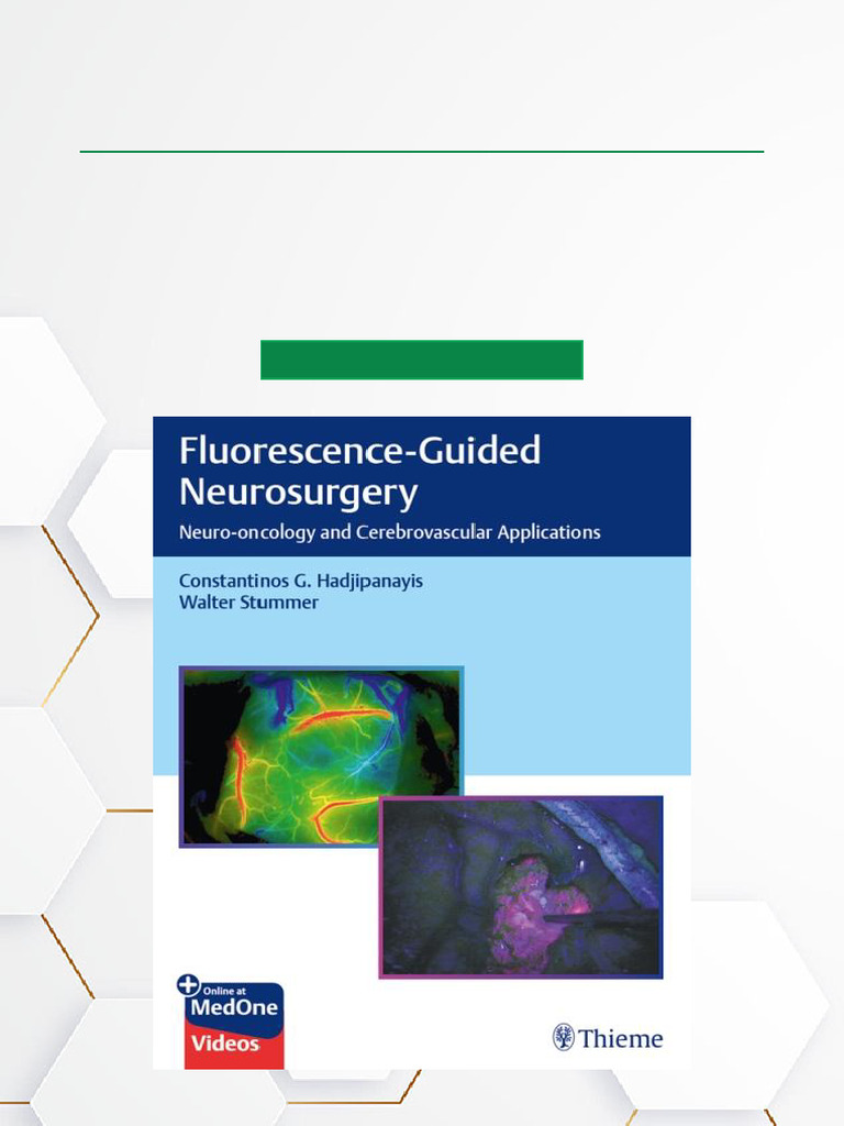Fluorescence Guided Neurosurgery Neuro Oncology and Cerebrovascular ...