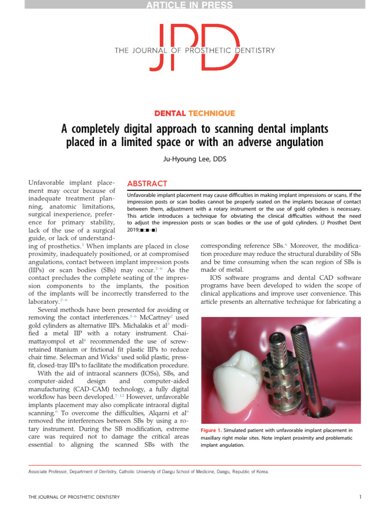 A Completely Digital Approach To Scanning Dental Implants Placed In A