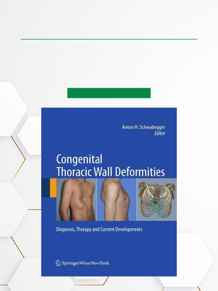 Congenital Thoracic Wall Deformities Diagnosis, Therapy and Current ...