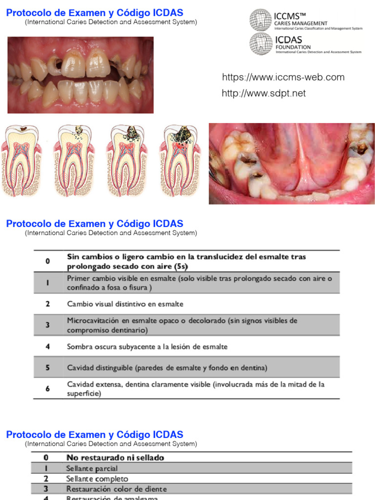 Protocolo y Códigos ICDAS 2025 | PDF | Esmalte de dientes | Diente