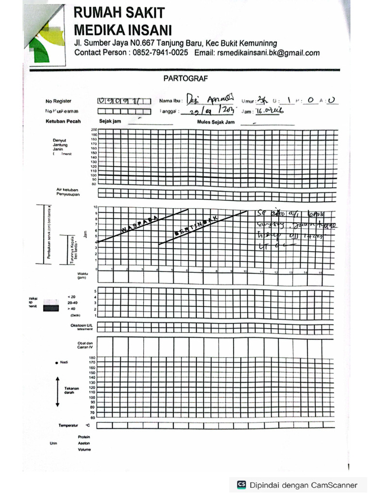 Partograf Desi Aprianti | PDF