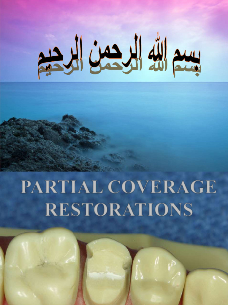 MacBoyle Retainer in Partial Coverage | PDF | Mouth | Dentistry Branches
