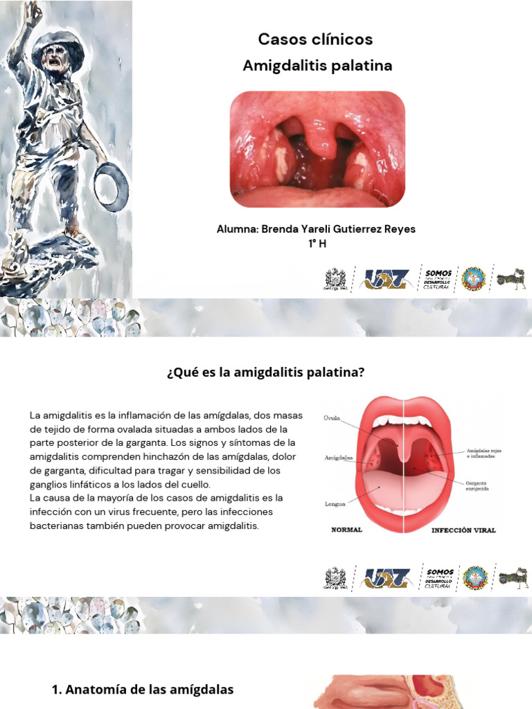 Amigdalitis Palatina | PDF | Vena | Sistema linfático