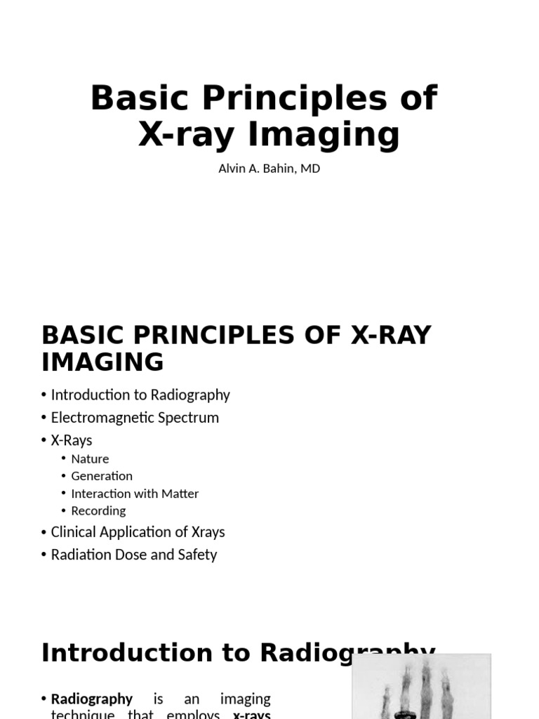 Basic Principles of Xray Imaging ALVIN BAHIN | PDF | X Ray | Radiography