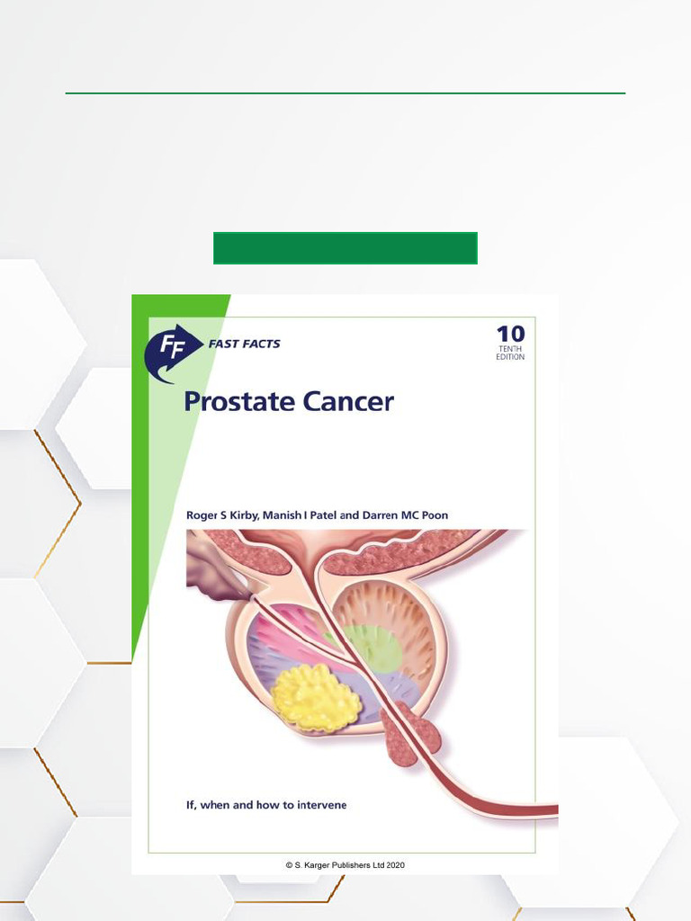Prostate Cancer: Intervention Guidelines | PDF | Prostate Cancer | Cancer