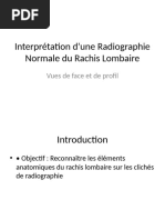 Examen Radiologique du Gril Costal | PDF | Thorax | Système squelettique