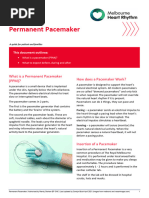 Epicardial Pacing Wire Removal Guide | PDF | Heart | Health Care