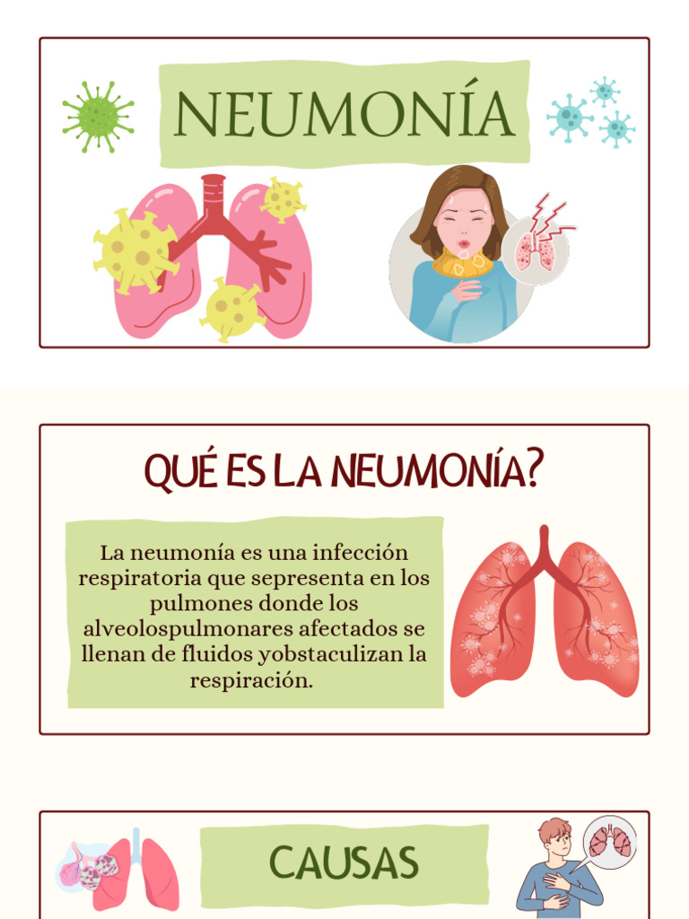 Neumonia | PDF