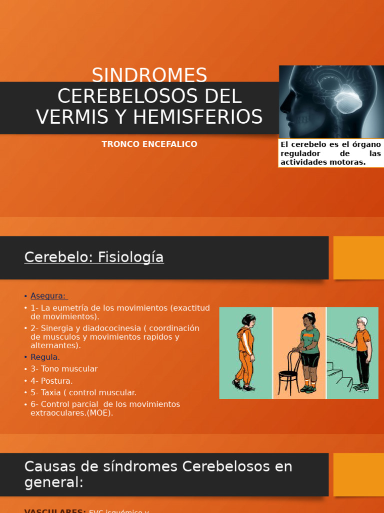 Síndromes Cerebelosos: Diagnóstico y Síntomas | PDF | Cerebelo ...