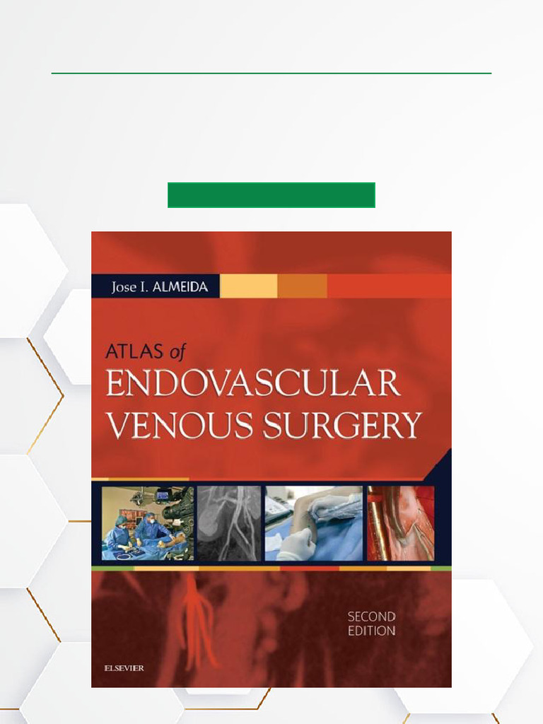 Atlas of Endovascular Venous Surgery 2nd Ed. | PDF | Vein | Varicose Veins