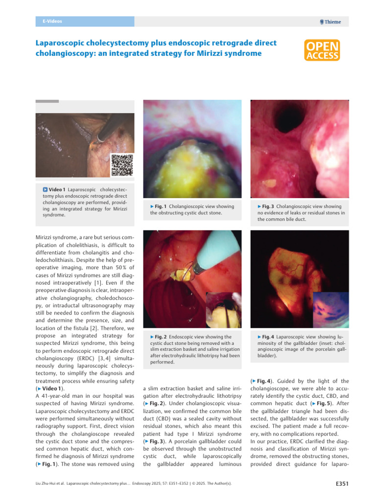Laparoscopic Cholecystectomy Plus Endoscopic Retro | PDF | Gallbladder ...