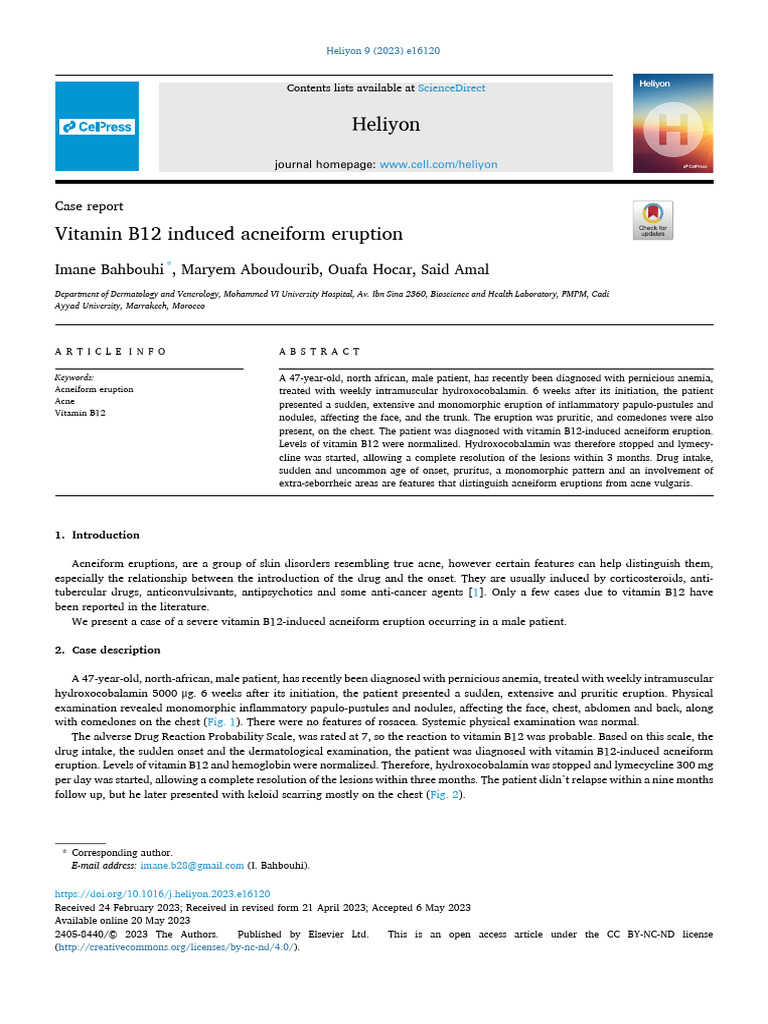 Vitamin B12 Induced Acneiform Eruption | PDF | Vitamin B12 | Cutaneous ...